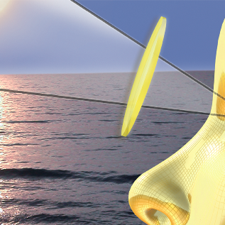 Aurium, hydrophobe photochrome 3 teilige IOL